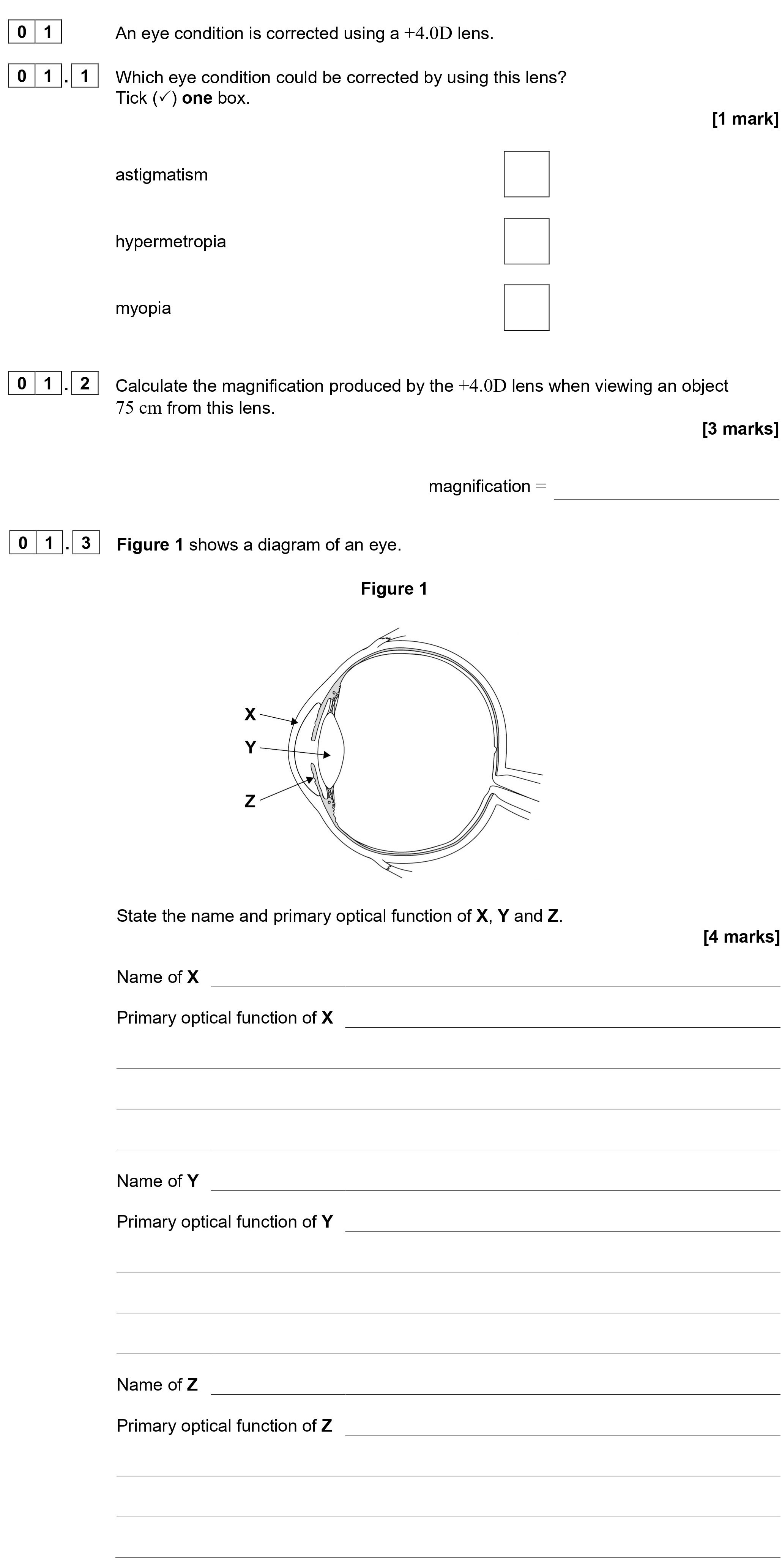 A-Level AQA Physics The Young Modulus: An eye condition is corrected us