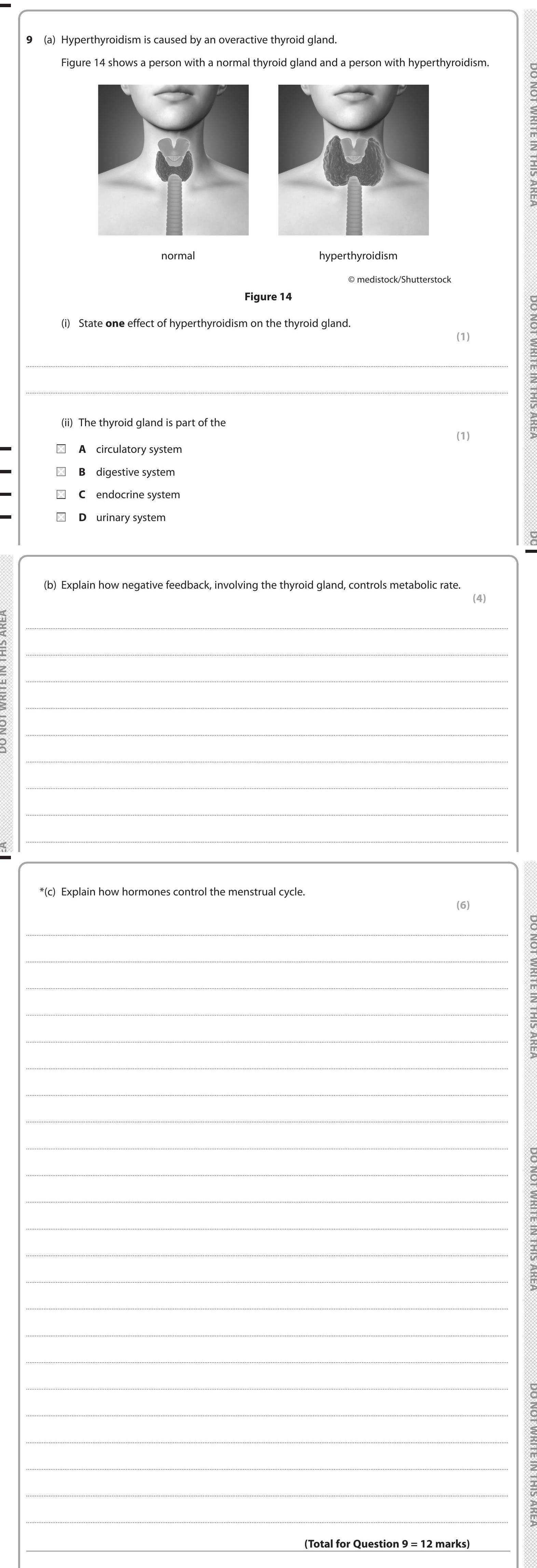 GCSE Edexcel Biology Menstrual cycle: 9 (a) Hyperthyroidism is caused